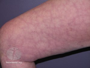 How many of the 8 'red flags' for unwell babies and children, do you ...